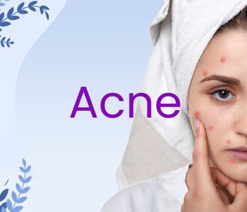 Acne – DelMeds.com